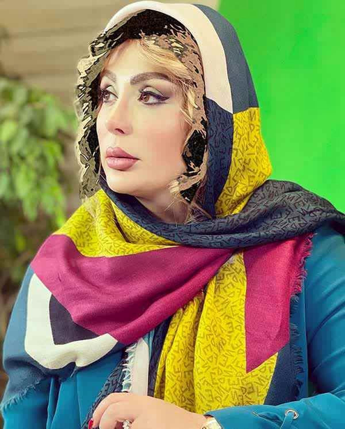 ریخت و قیافه نیوشا ضیغمی قبل معروفیتش نیوشا ضیغمی چی بود چی شد؟